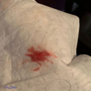 Colitis In A Cocker Spaniel: What Pet Parents Should Do - Fidose of Reality